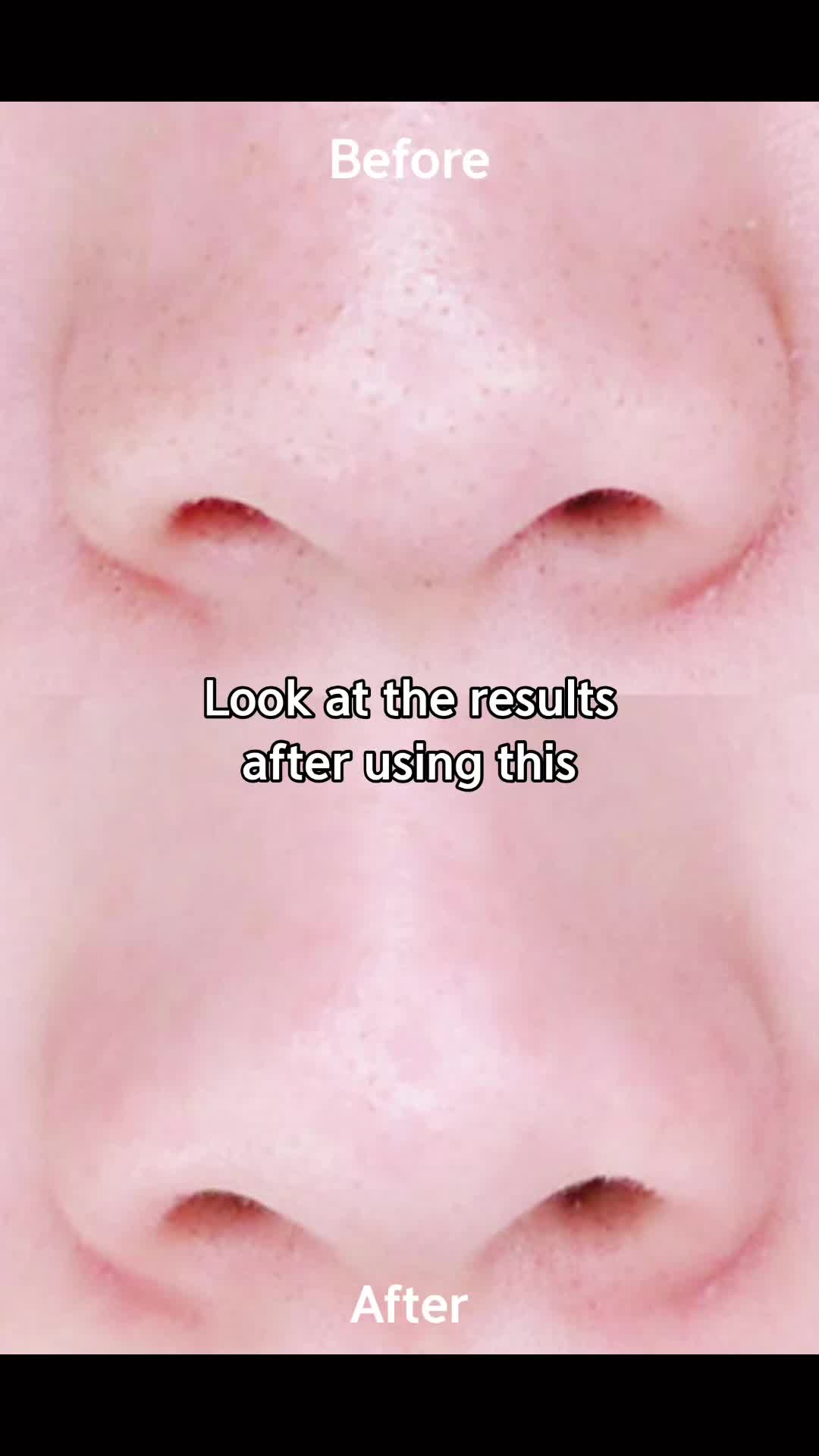 Have you seen a two step nose trip | STYLEKOREAN (@stylekorean_official)