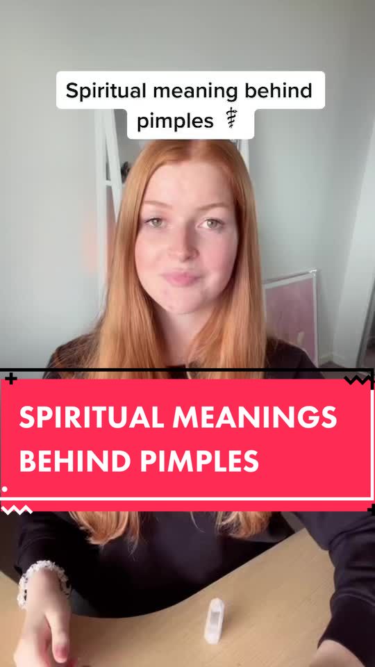 SPIRITUAL MEANING BEHIND PIMPLES ⚕️😎 | Nicole | 5D Psychic Medium (@euphoricenergyhealings)