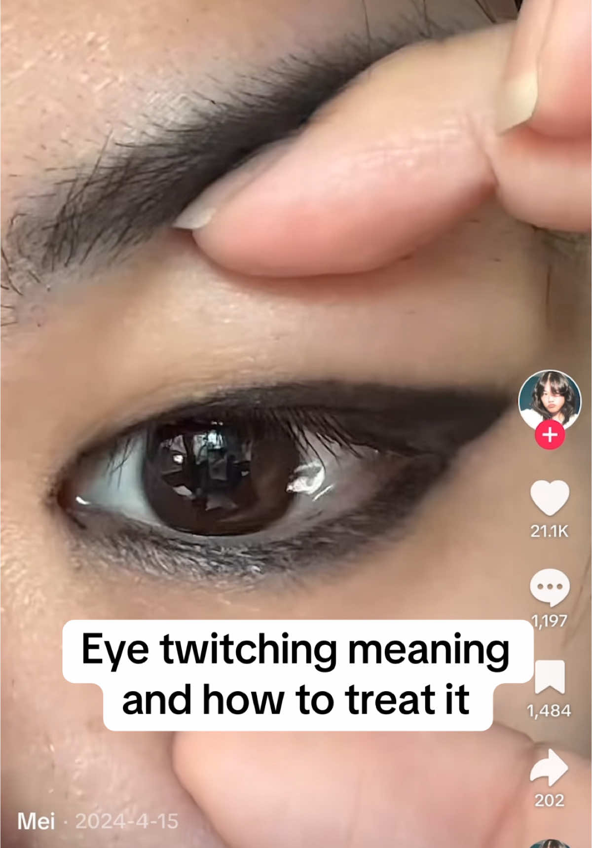 Eyelid twitching meaning and how to | EYEsthetics | Optometrists🇨🇦 ...