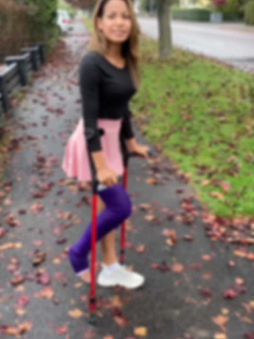 Long Leg Cast 💜 | Casted Girls (@casted.girls)