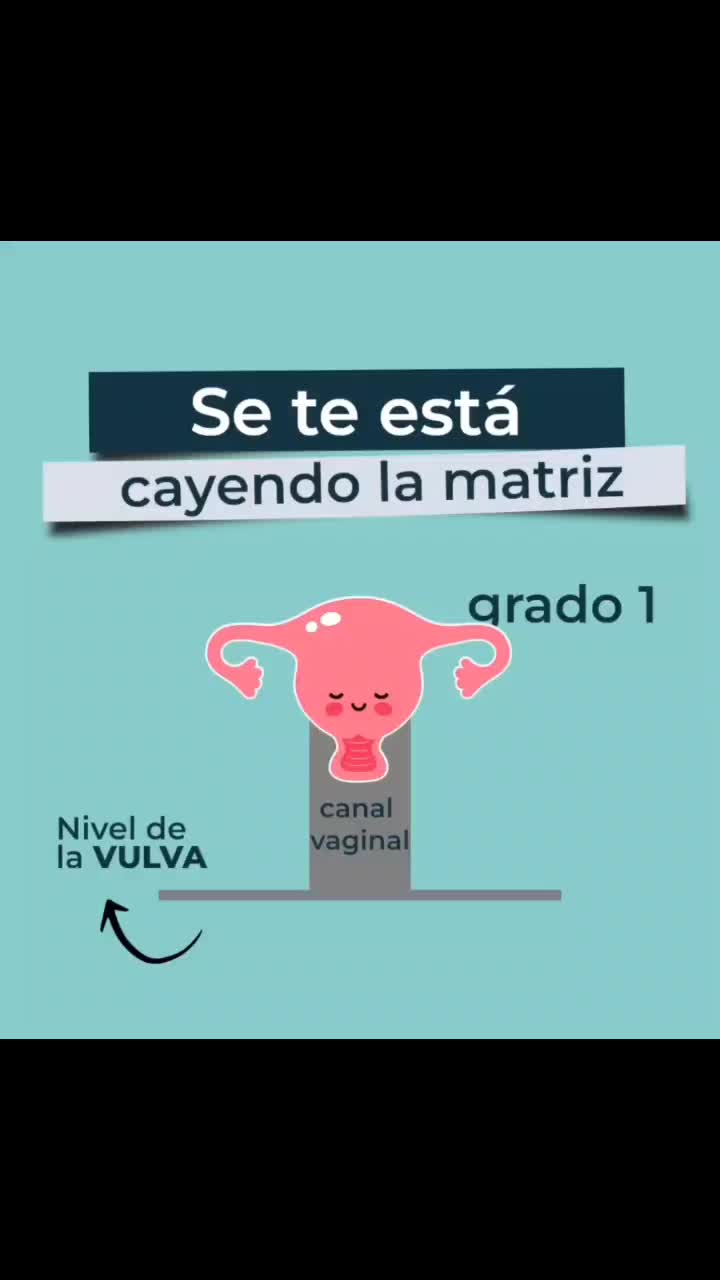 Sabes lo que es un prolapso uterino o | 🌸DRA Milagros Orozco🩺👩🏻‍⚕️ ...