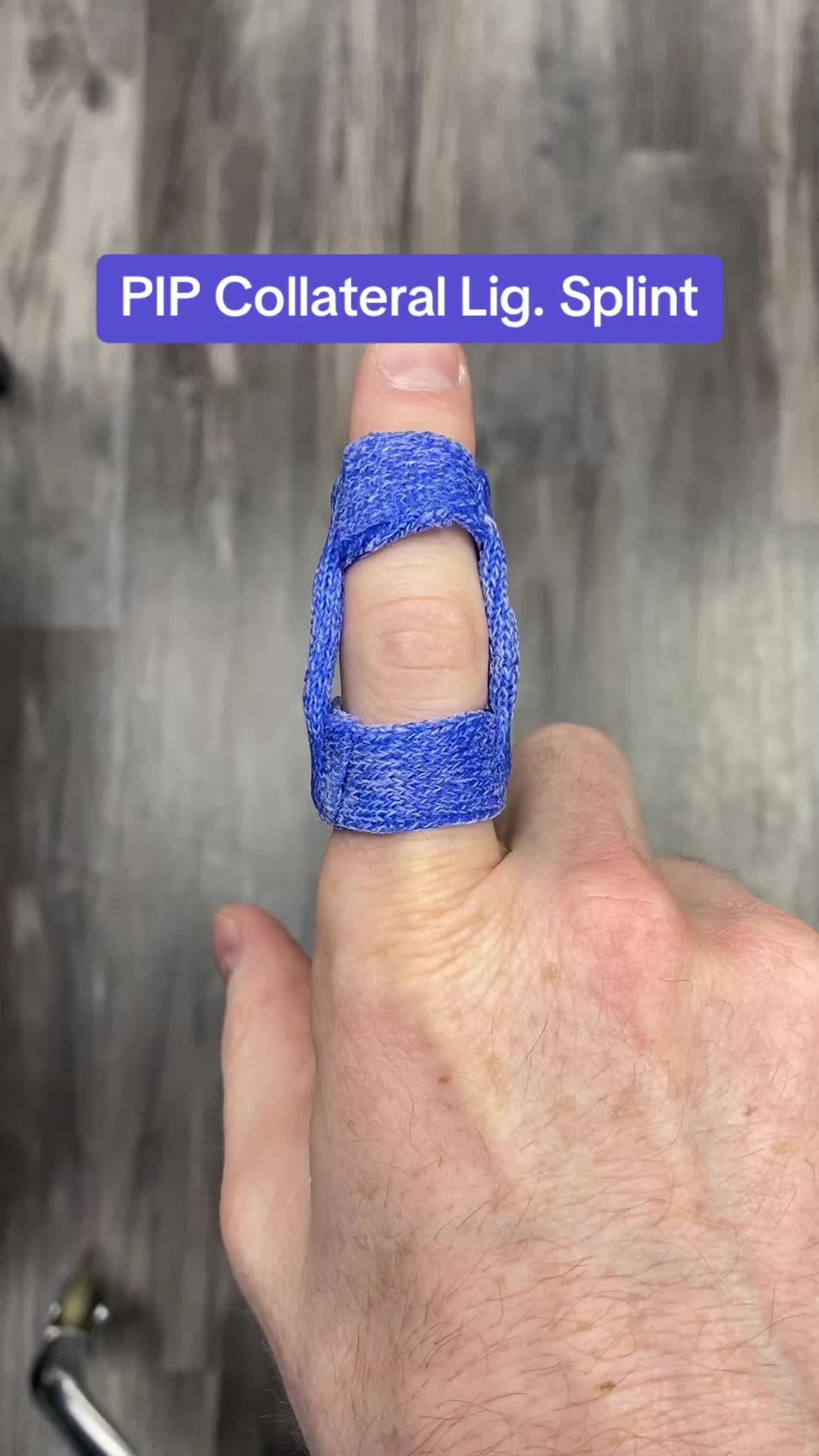 Collateral Ligament Splinting🖐️ | Hand Therapy Academy ...