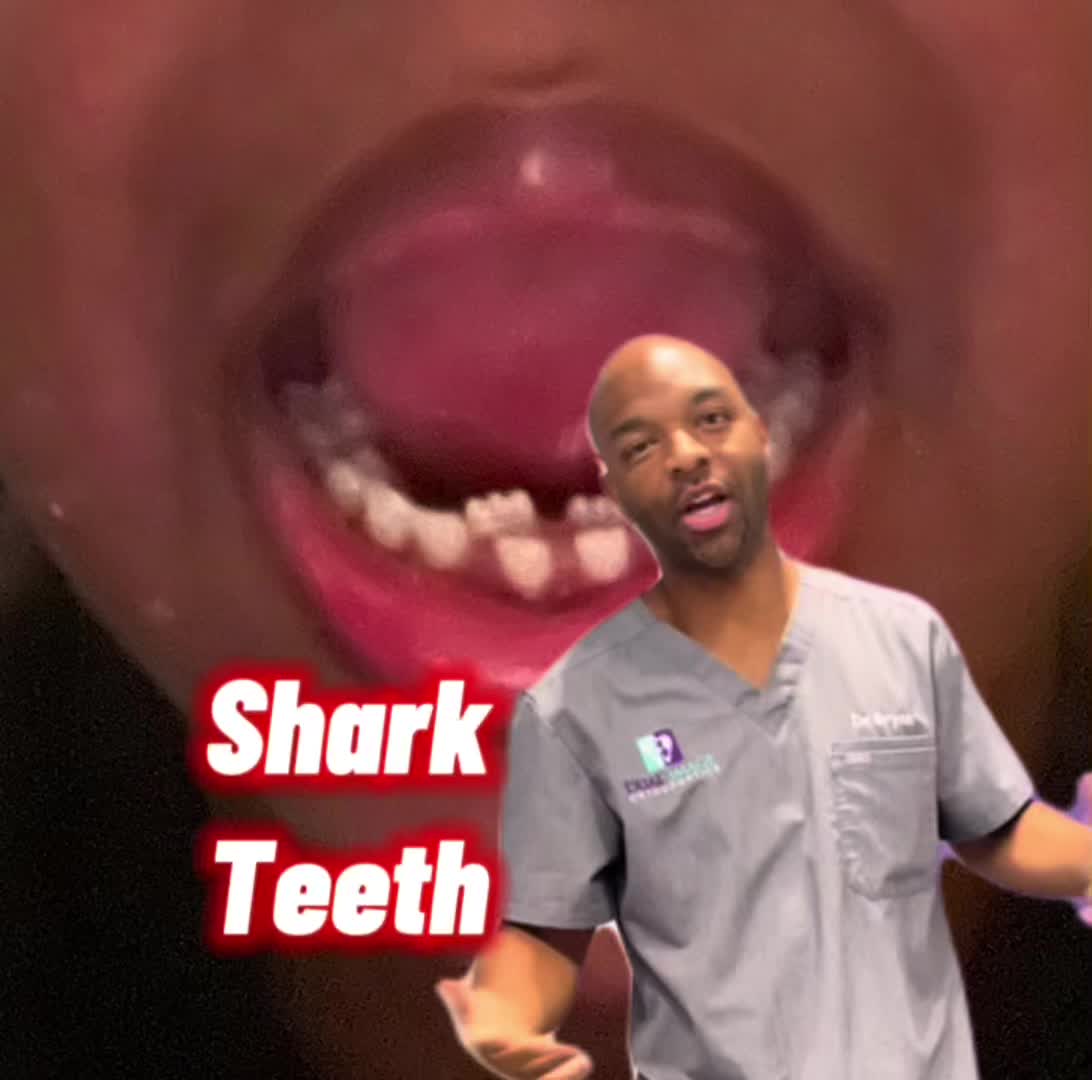 Two rows of teeth, what to do??😱 | orthobmac (@orthobmac)