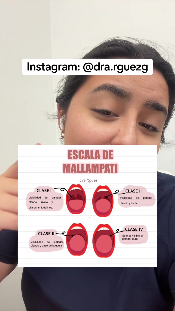 ESCALA DE MALLAMPATI ‼️#medicina | dra.rguez (@dra.rguez)