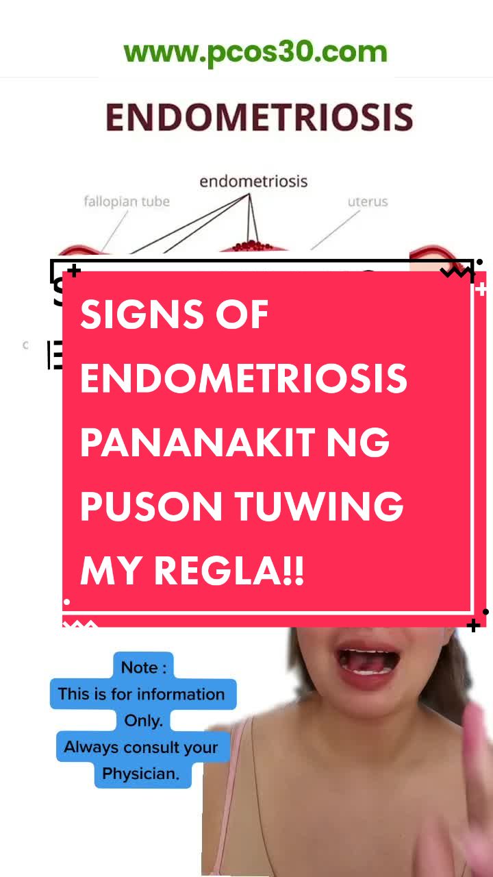 Pananakit ng Puson tuwing my regla | Pcos Coach Barbie (@pcoscoachbarbie)