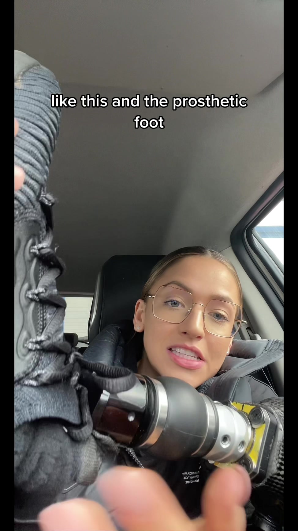 What happens to my prosthetic legs once | Milly Pickles (@millypickles)