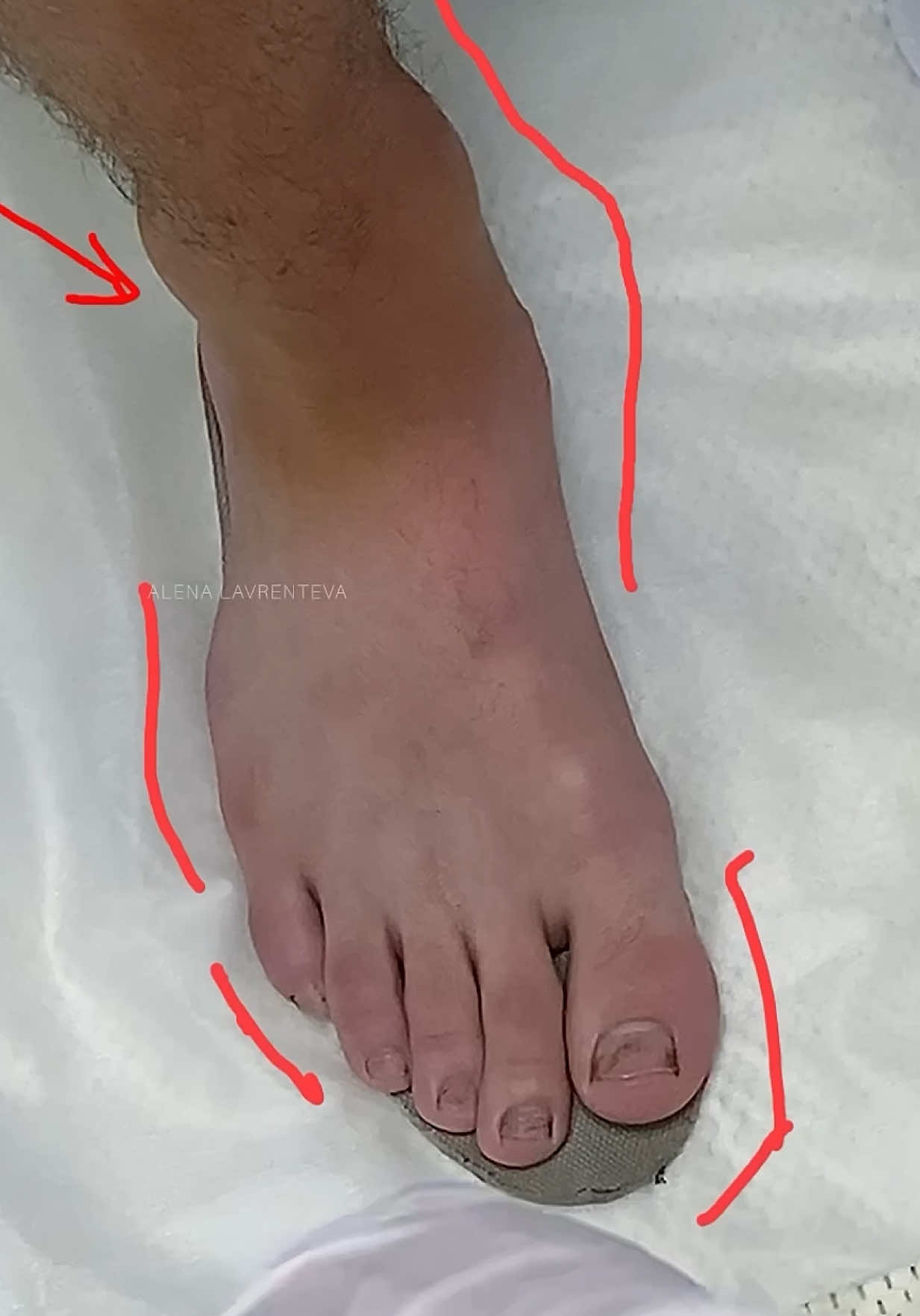 Just left the Rising Phoenix morning | lynleylifts (@lynleylifts)