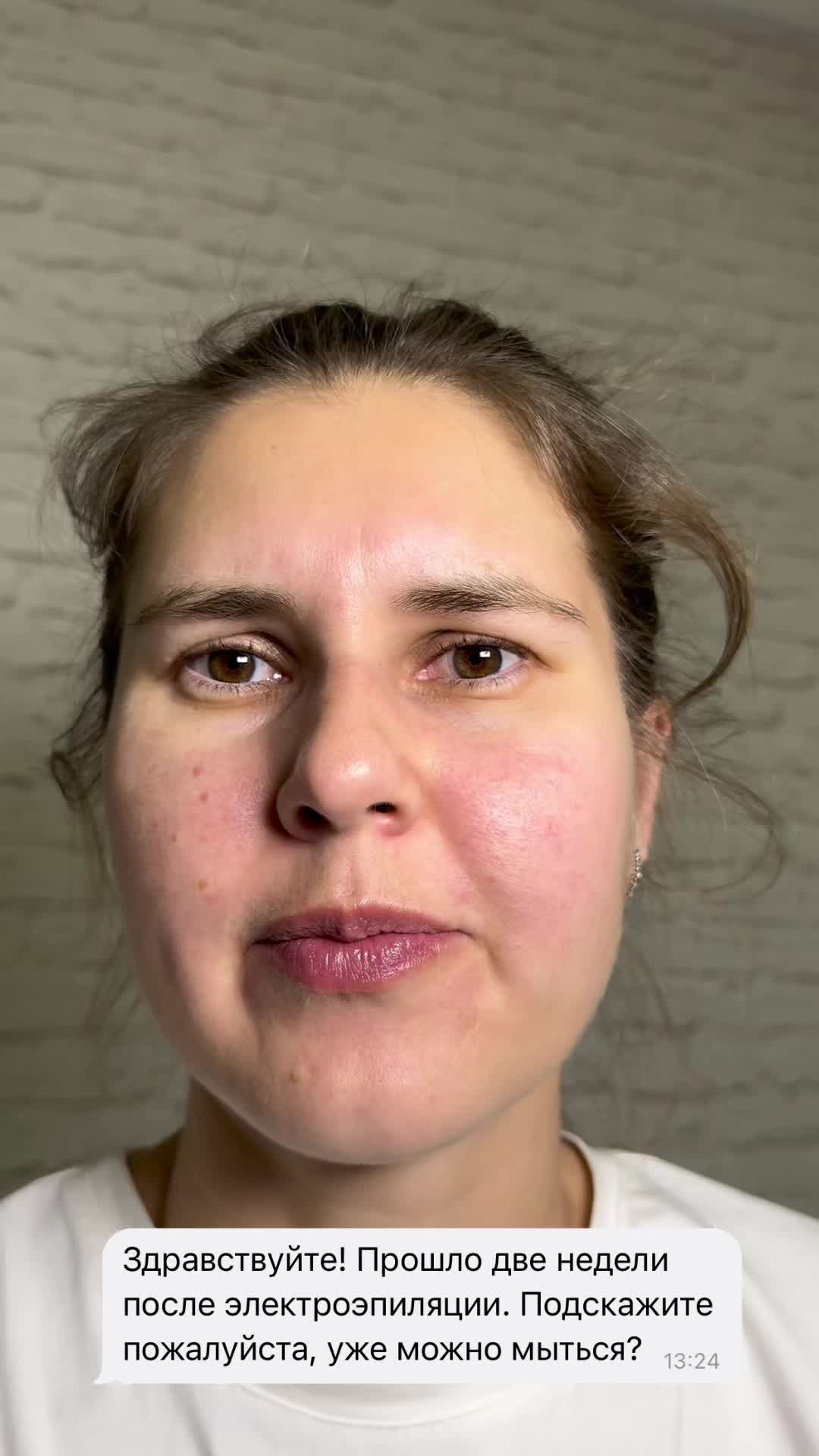 Дорогие клиенты🌷 не мочить обработанную | Герониме электроэпиляция ...