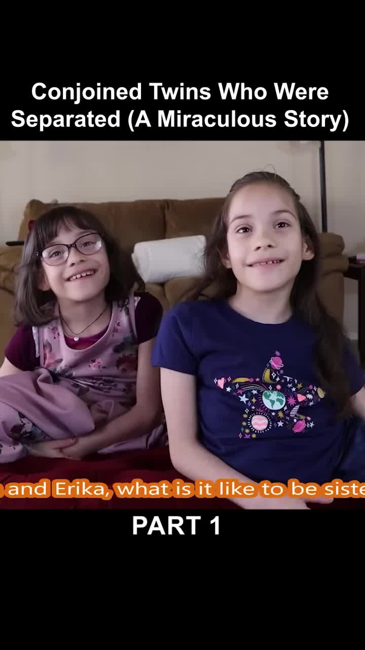 Conjoined Twins Who Were Separated (A | True Story Documentary ...