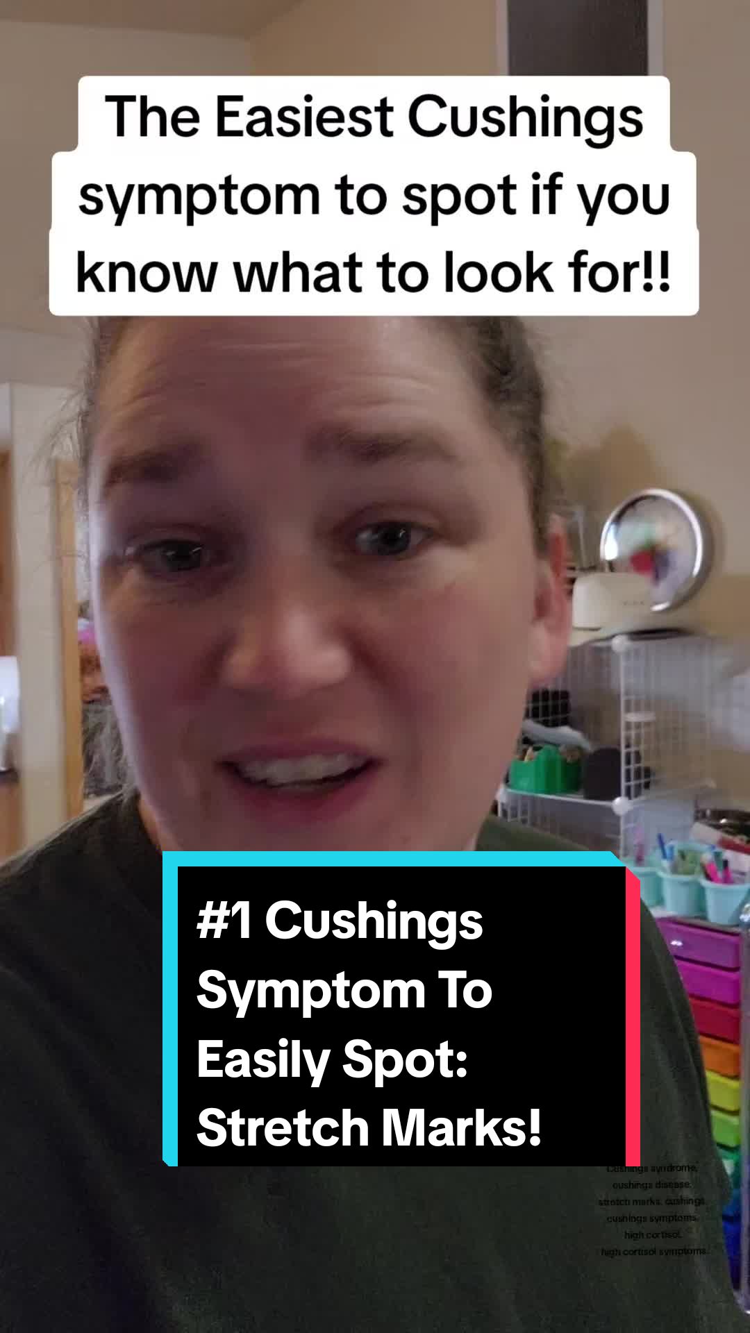 A very visible symptom of cushings | Ariel | Cushings Companion ...