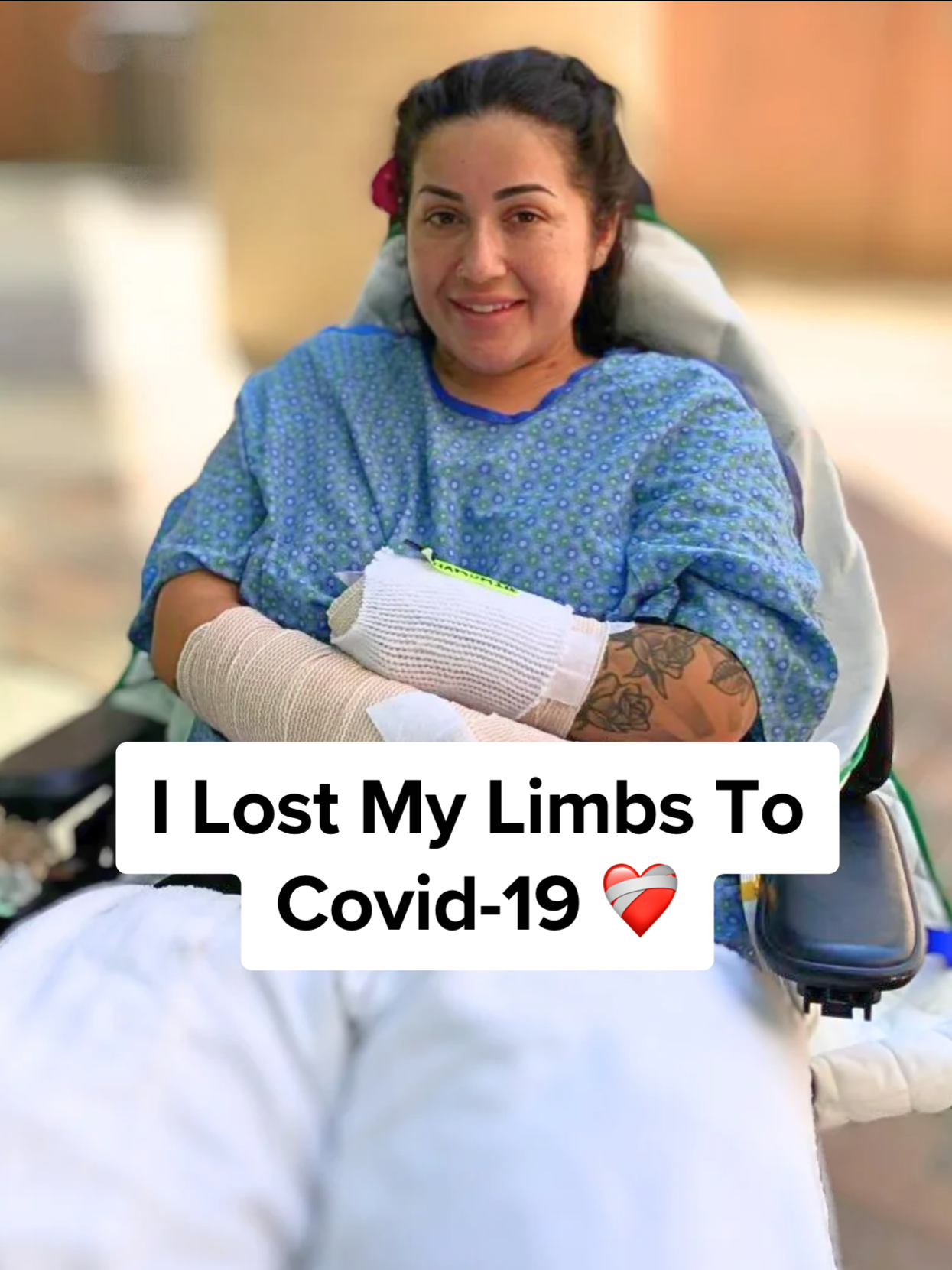 I lost all my limbs after catching | Truly Show (@truly_show)