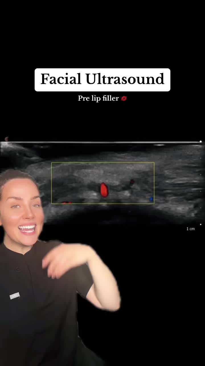 Facial ultrasound | How I assess and | Dr Kara | Aesthetic Doctor ...