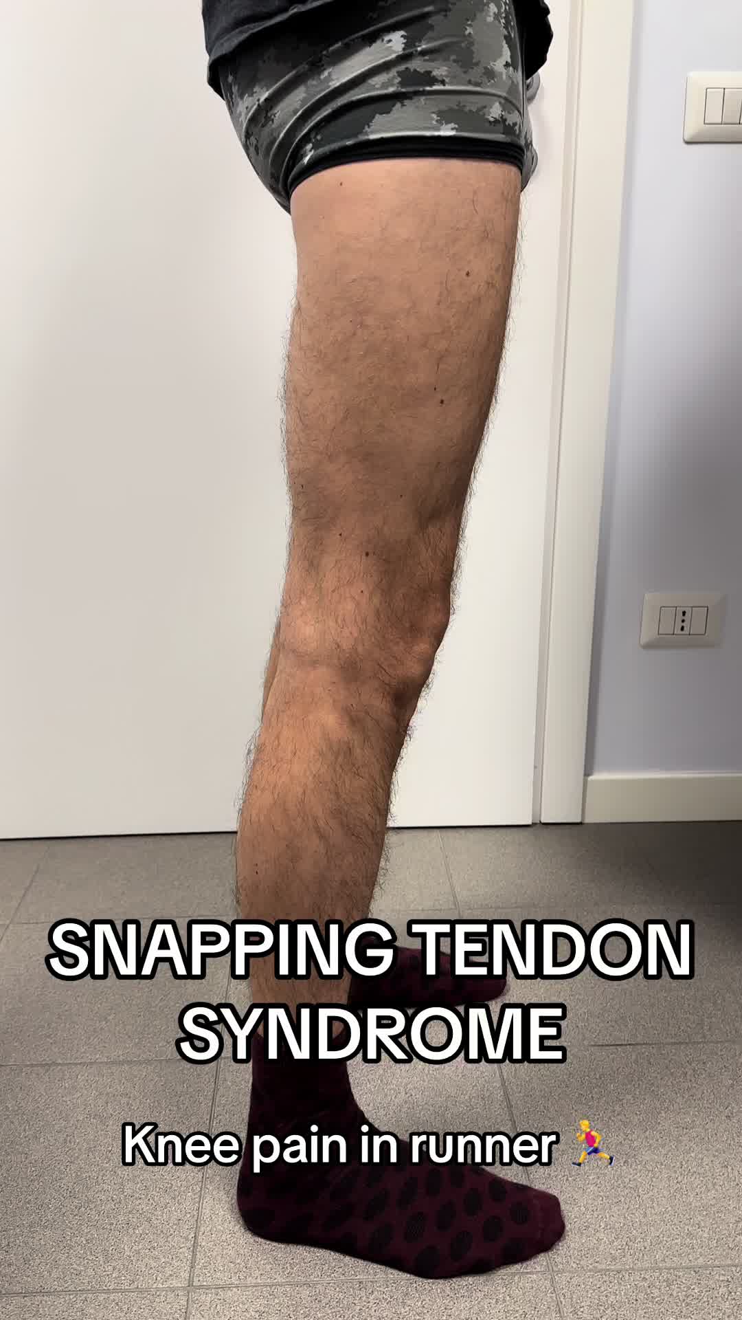 BICEPS FEMORIS SNAPPING SYNDROME has | DR.BaratellaPhysioOsteo (@dr ...